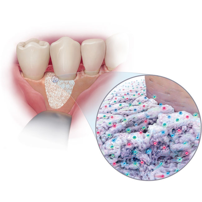 GEM 21S®: Helping You Heal | Shop GEM 21S® - Lynch Biologics